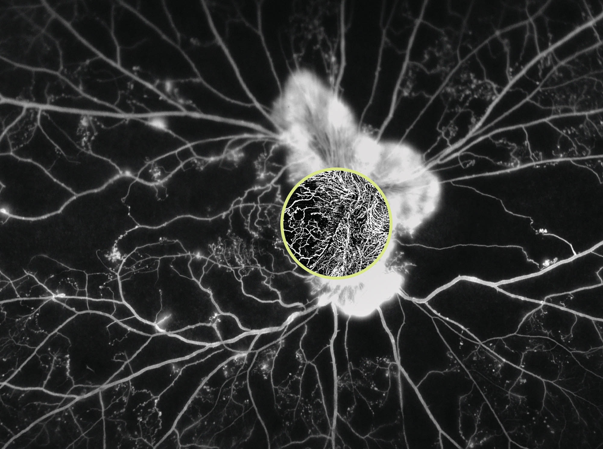 Revolutionize your practice with OCT Angiography