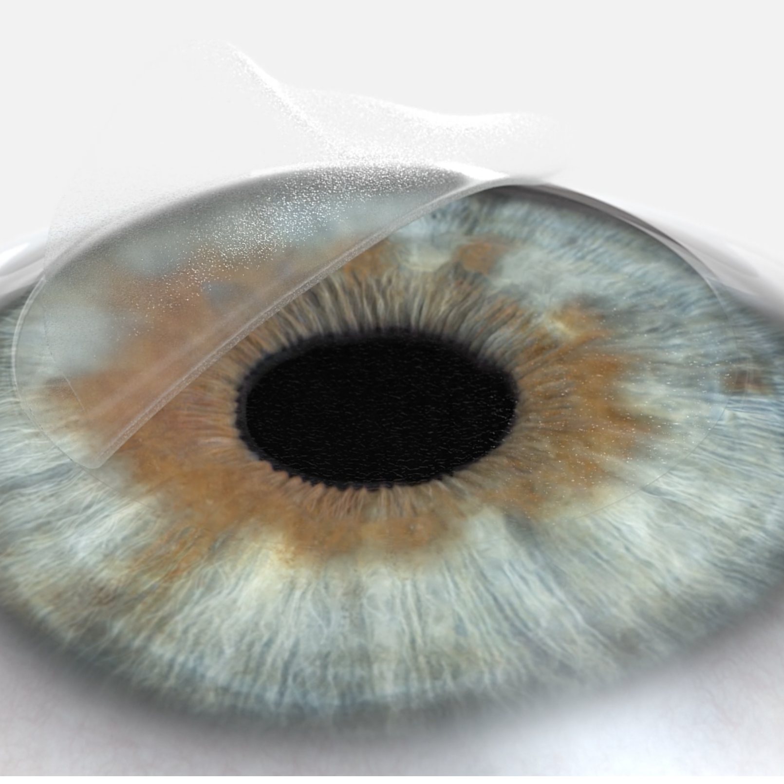 Chirurgie oculaire au laser LASIK | ZEISS